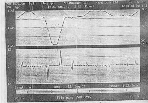 NON-DESTRUCTIVE TESTING OF STEEL WIRE ROPES AND THEIR DISCARD CRITERIA ...